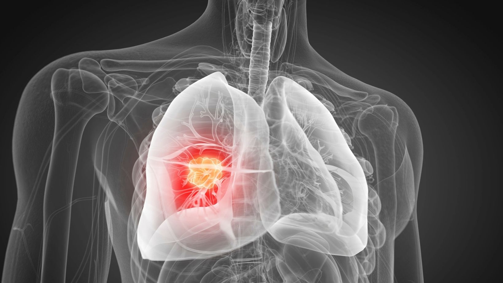 EntroGen: kits predictivos, preventivos y personalizados apoyan las ...